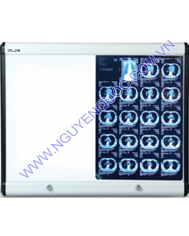 ĐÈN ĐỌC PHIM X-QUANG DILOS-200
