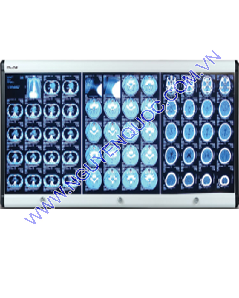 ĐÈN ĐỌC PHIM X-QUANG DILOS-300